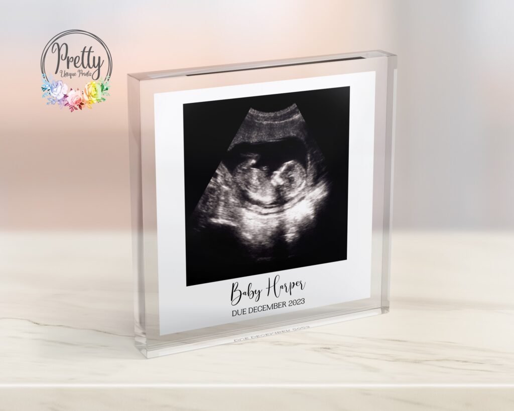 Personalised Baby Scan Photo Block | Pretty Unique Prints Ltd.